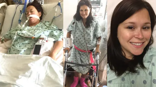 US Woman Nearly Died After Brushing Off Sepsis Symptoms As Flu | Dailyhunt