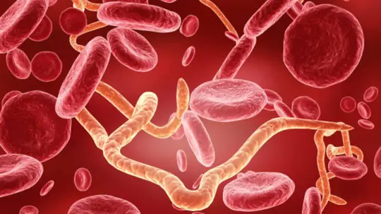 Ebola Outbreak: Cases In Congo Reach 933, Death Toll Climbs To 245 ...