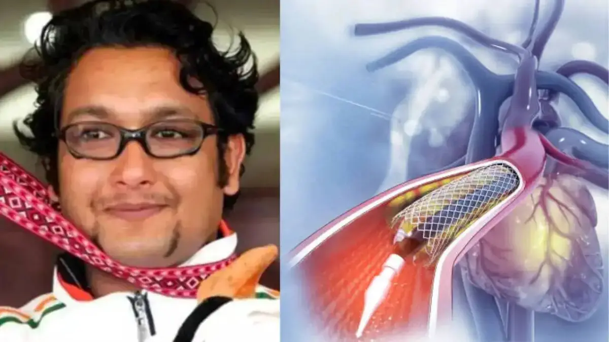 Understanding Heart Stents: Risks and Recovery Insights | Dailyhunt