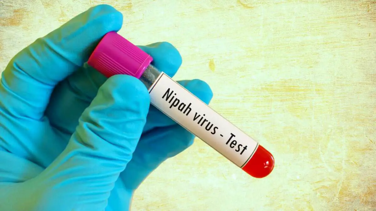 Nipah virus: Facts, symptoms and current risk levels | Dailyhunt