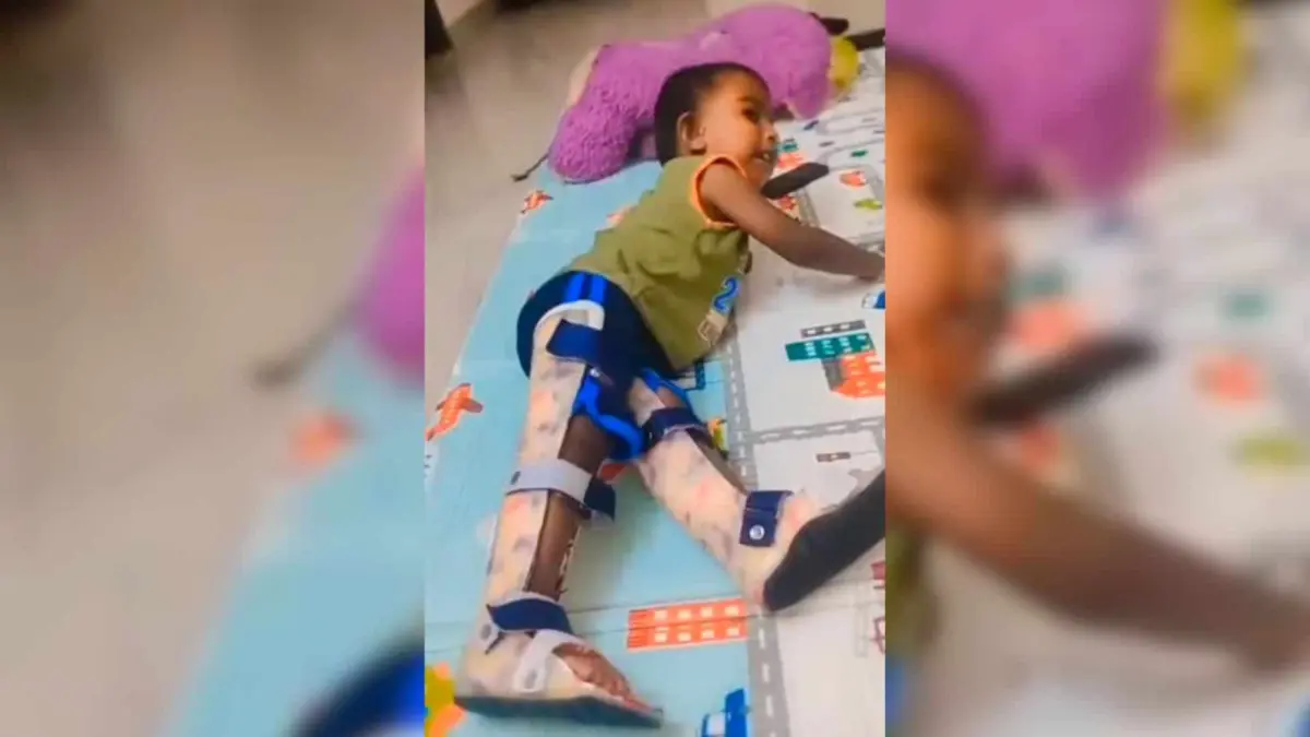 Telangana CM assures treatment for baby with SMA | Dailyhunt
