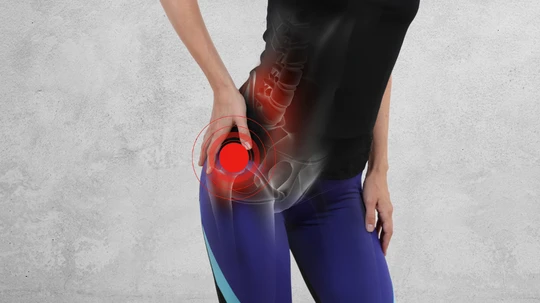 That Persistent Hip Pain Could Be an Early Warning Sign of Bone Damage ...