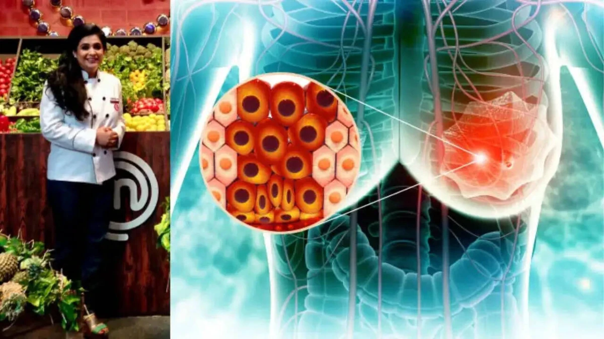 Celebrity Chef Pankaj Bhadouria's Breast Cancer Diagnosis Highlights ...