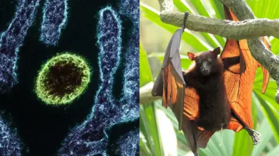 77 people on contact list, route map soon; Nipah officially confirmed ...