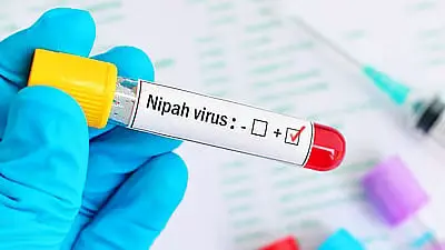 ICMR team arrives in Kozhikode after Nipah case confirmation; contact ...