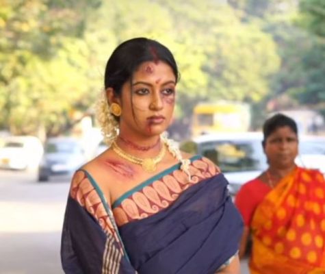 பாரதிக்கண்ணம்மாவுக்கு திடீர் விபத்து.?! பகீர் புகைப்படத்தால், ரசிகர்கள் ஷாக்.! - Seithipunal