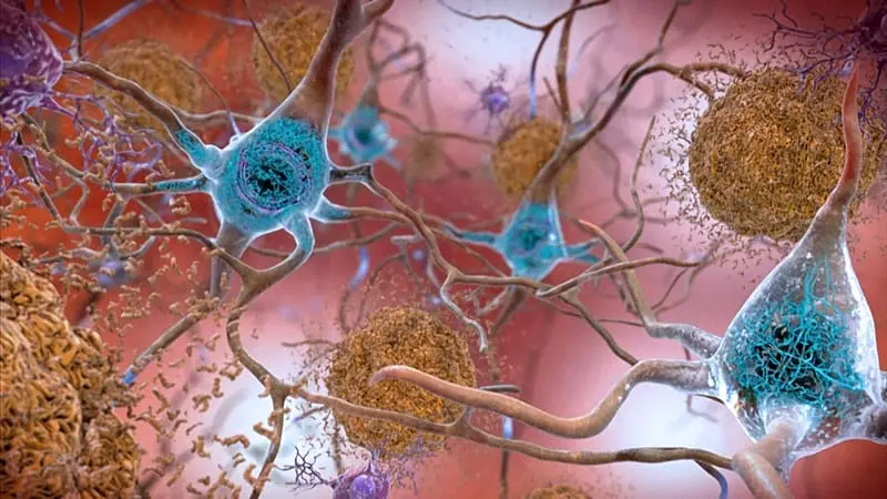 A blood test could flag Alzheimer's risk early. But how reliable is it ...