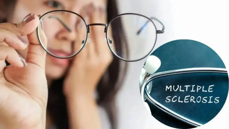 Understanding Blurred Vision: A Possible Indicator of Multiple ...