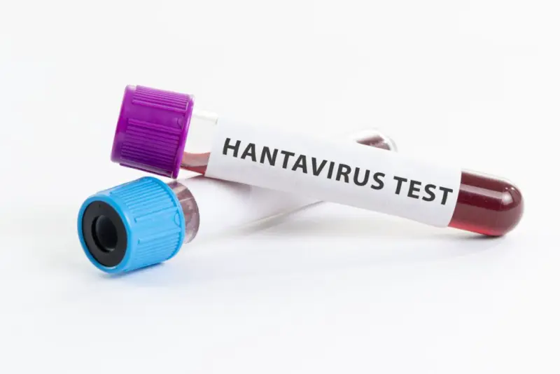 Hantavirus outbreak sparks concern, experts say India faces low risk ...